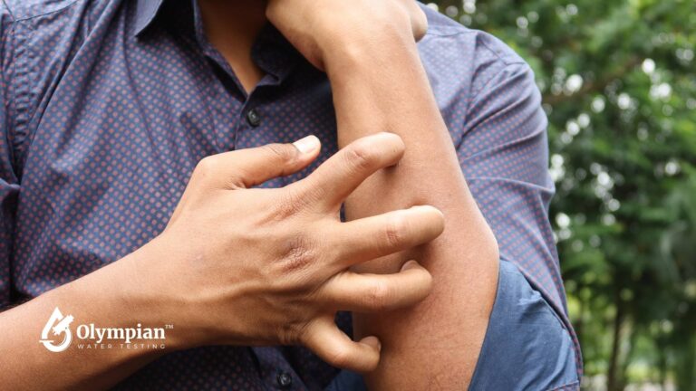 Why Some Well Water Causes Skin Irritation and Dryness - Olympian Water ...